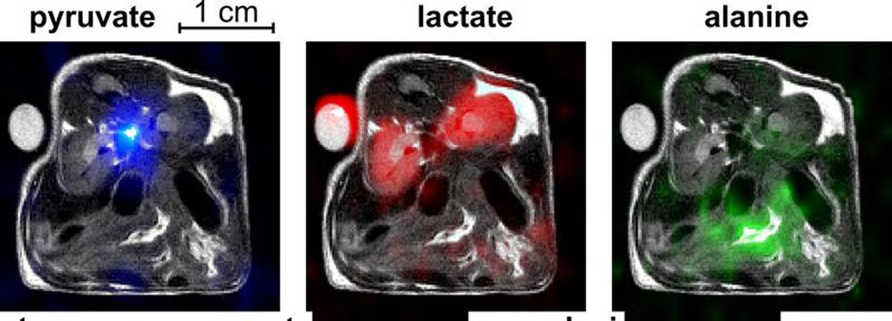 Advancements in Cancer Imaging: New Method Enhances MRI - Innovations ...