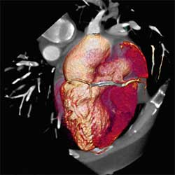 Innovative technology for computed tomography: higher-quality images at ...