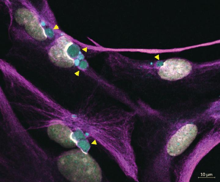 Scientists identify underlying molecular mechanisms of Alexander ... Scientists identify underlying molecular mechanisms of Alexander ...