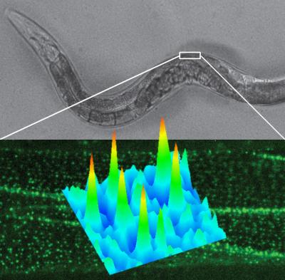 New Microscopy Technique Reveals Insights Into Muscular Dystrophy ...